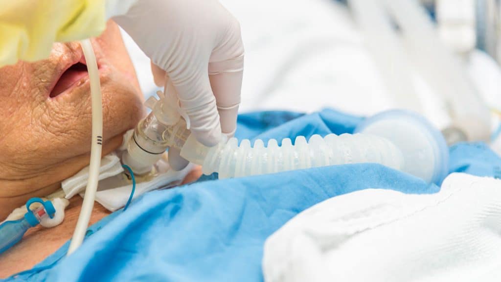 Algunas UCRIs han multiplicado por cuatro su capacidad en camas para ...