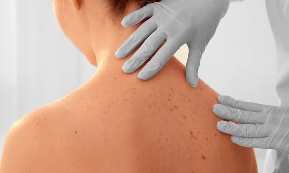 Dermatología | Noticias en Salud
